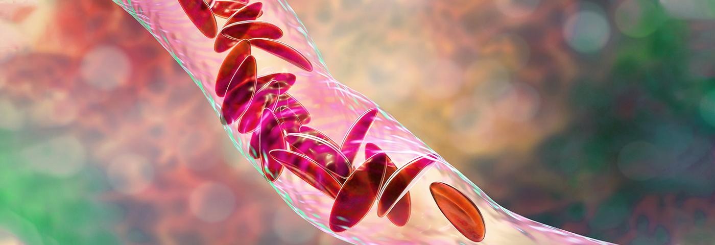 Delivering Breakthrough Medicines for Rare Hematologic Diseases and Cancers