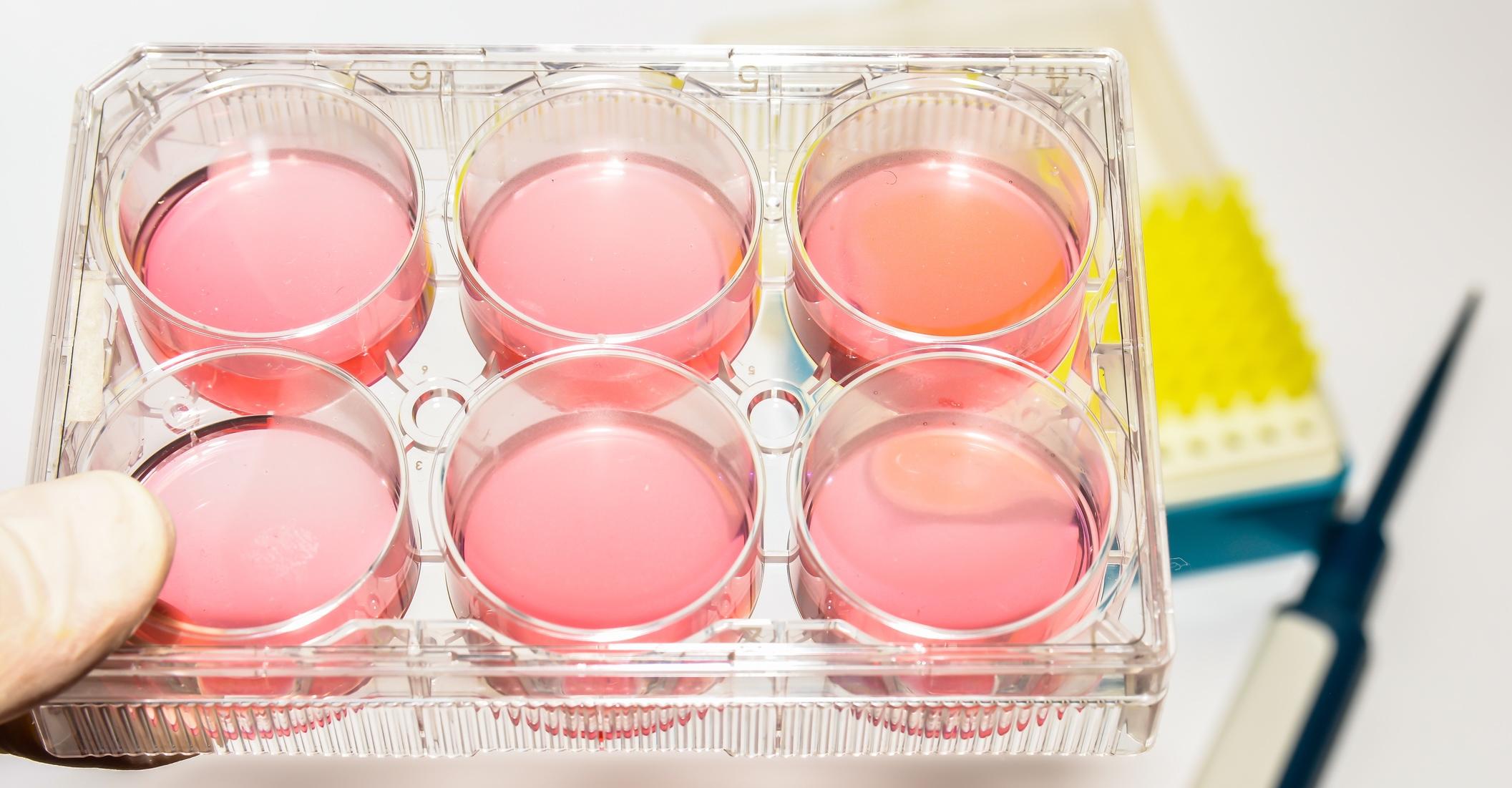 Built for Speed and Scale: How CDMO Cell Line Platforms Are Reshaping ...